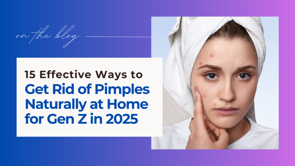 15 Effective Ways to Get Rid of Pimples Naturally at Home for Gen Z in 2025